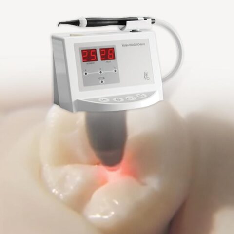 DIAGNOdent Laser Cavity Detection Technology - Something to Smile About ...